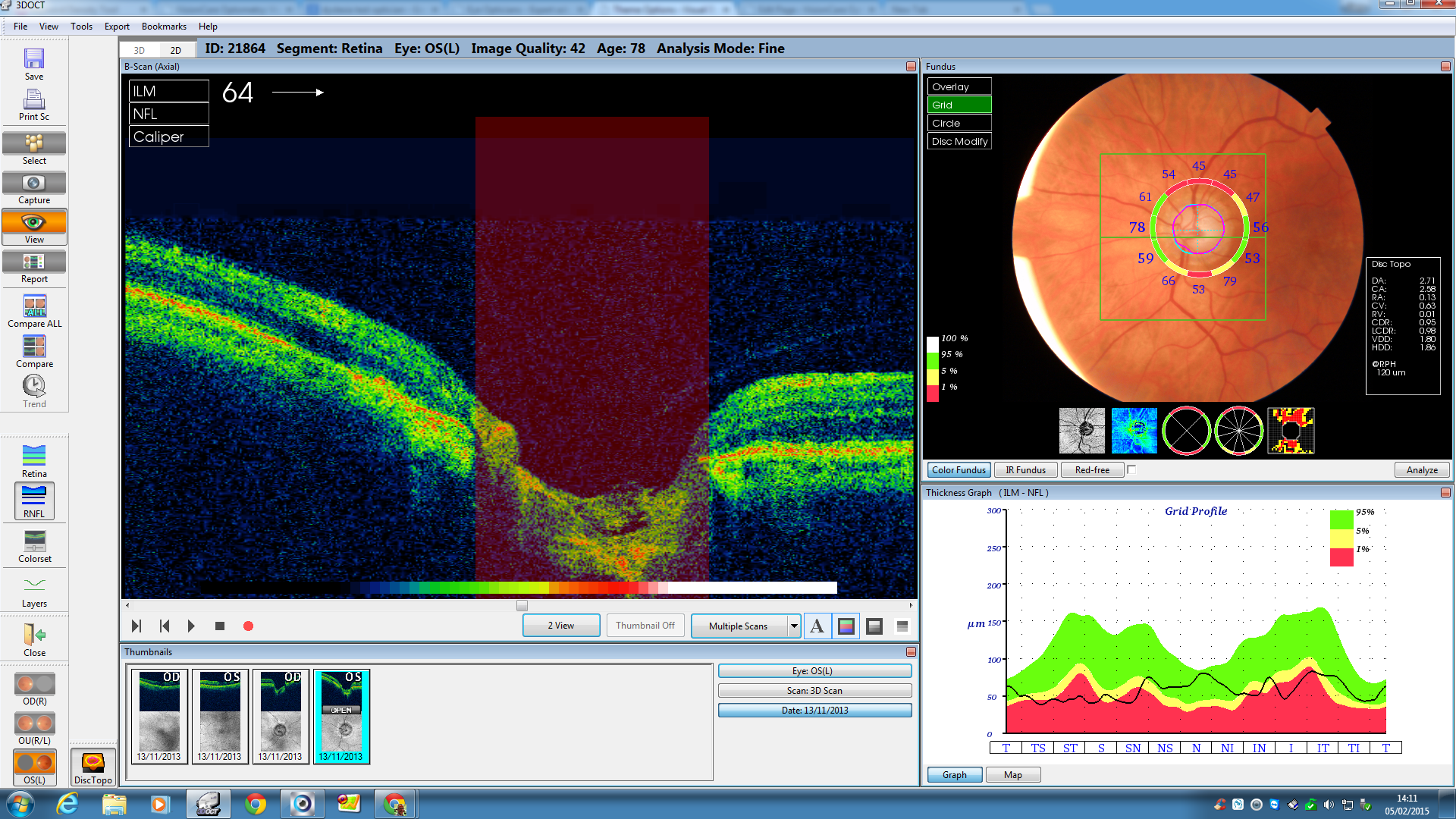 Optical photography ~ VisionCare Optometry